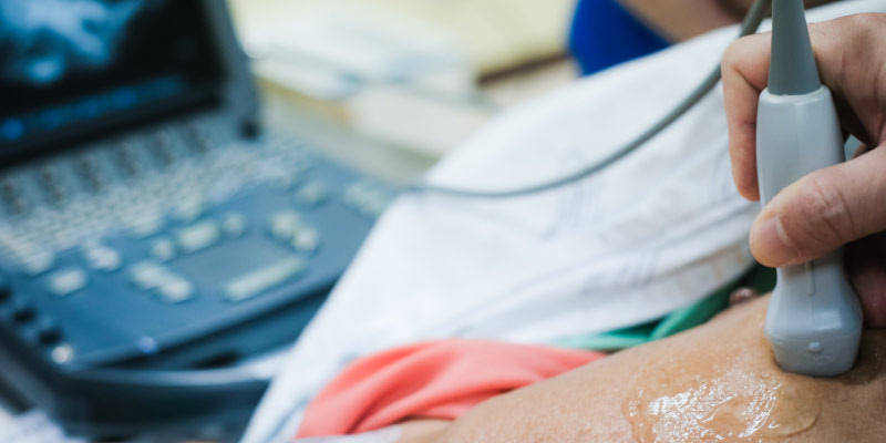 What is an Echocardiogram?